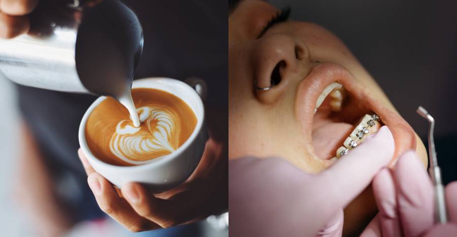 7 tips to reduce stains on teeth if you're a coffee- or tea-drinker ...